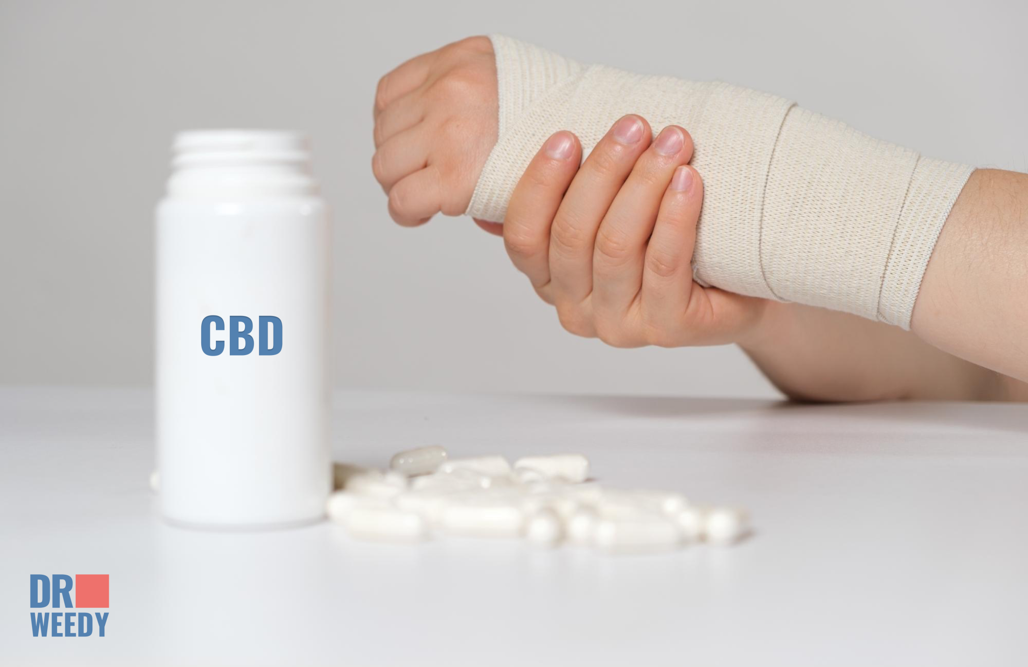 CBD for Broken Bones — Unknown Powers of Medical Weed
